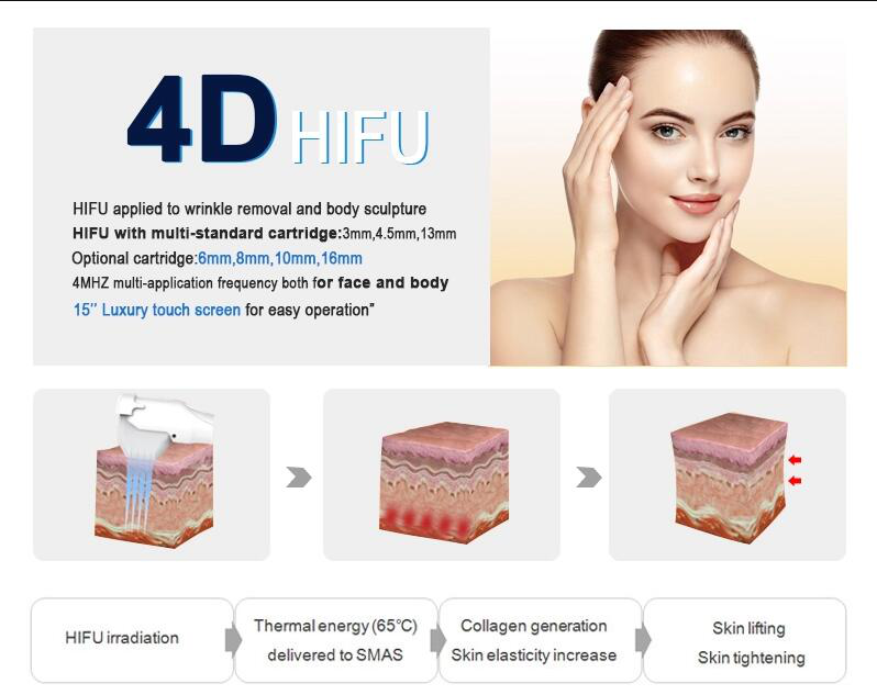 Some knowledges of HIFU Lifting System - Beijing Starlight S&T Development
